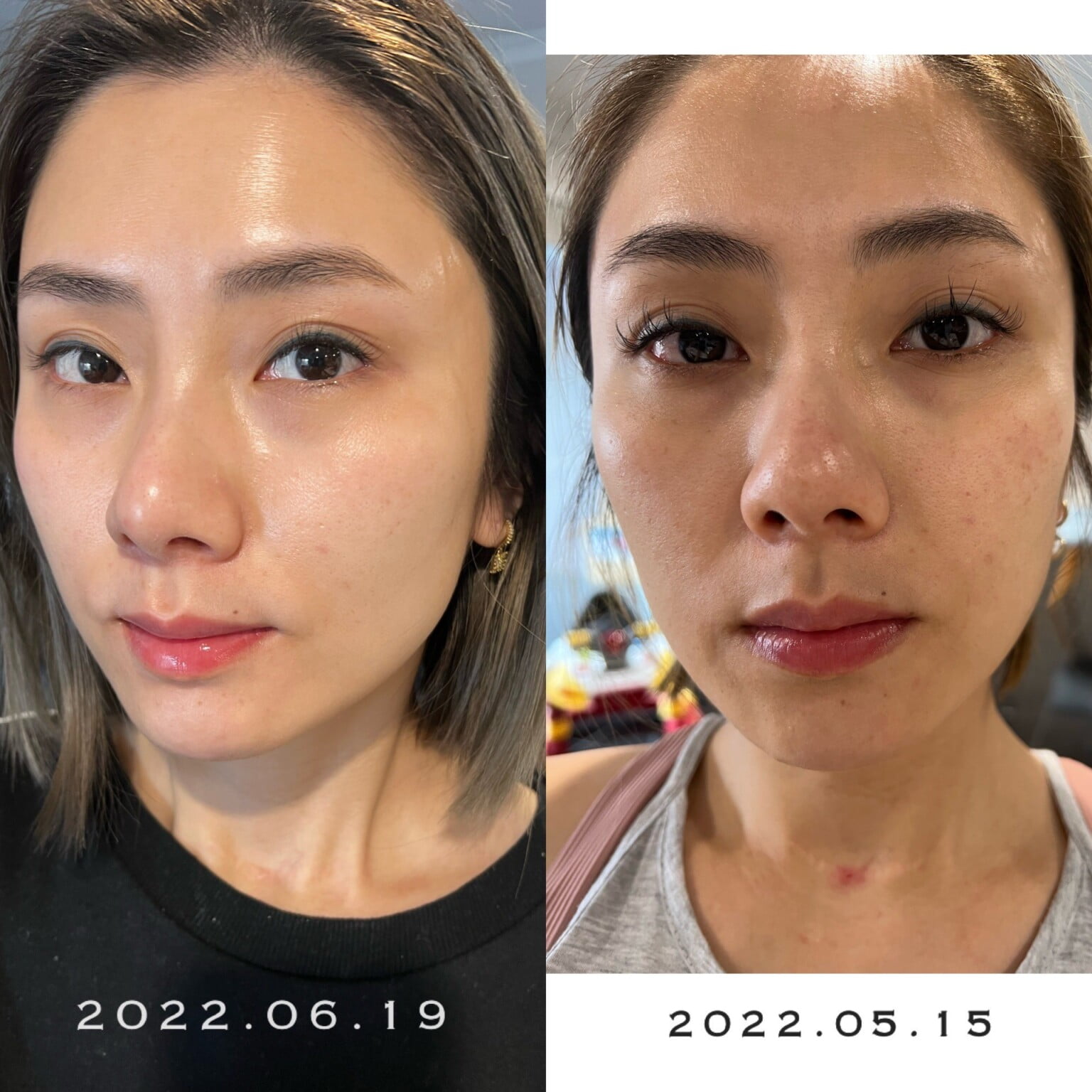 Maggie Wang：相信自己，給自己一個改變的機會 | 全美世界 SUPER體系│皙之密DR's Secret